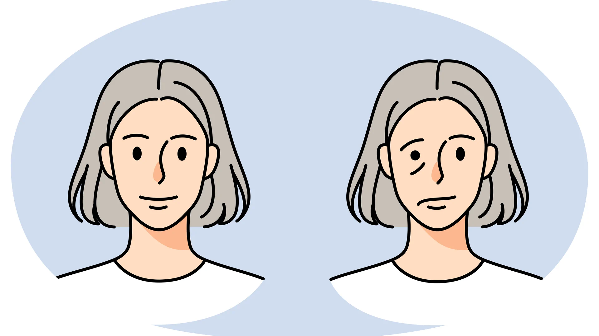 Bell's Palsy, its Symptoms, Treatment, and Rehabilitation